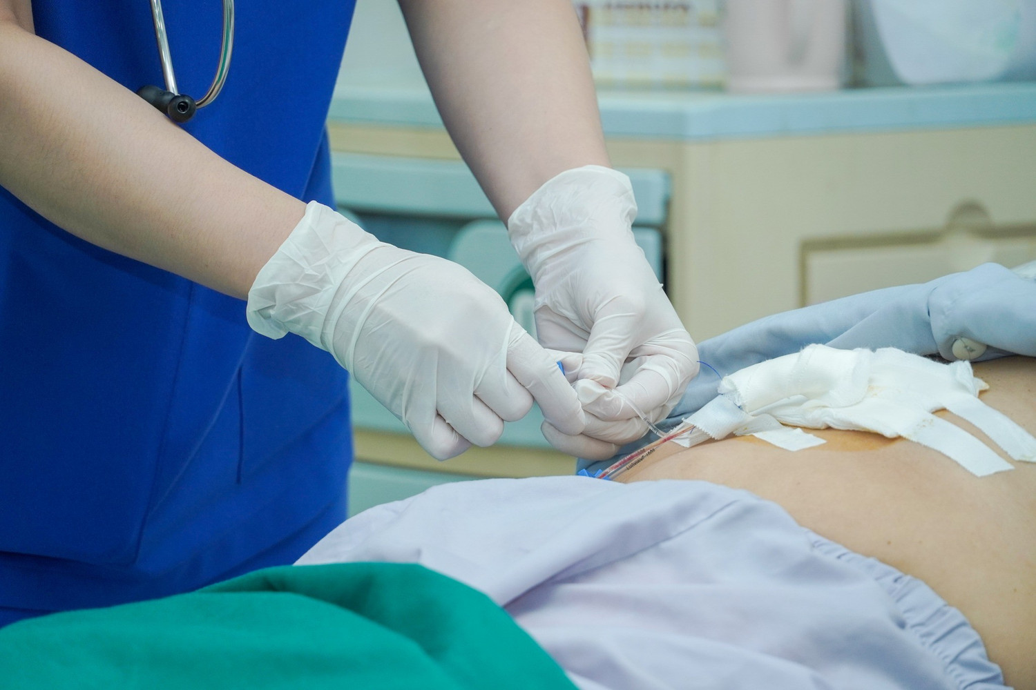 500ml dịch bao quanh tim, người phụ nữ nhập viện vì lồng ngực bị bóp nghẹt